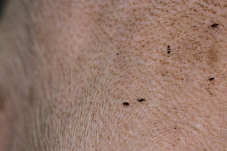 Fleas on Dogs: Causes, Symptoms, Treatment, and Prevention